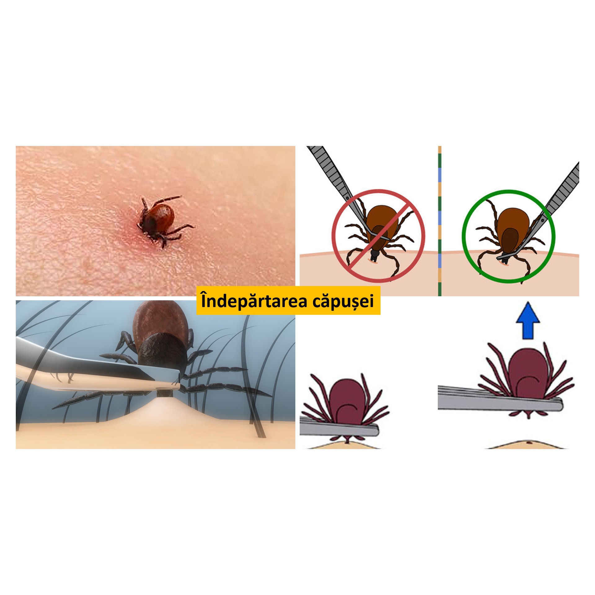 Set Insecticide anti capuse, tantari, muste, gandaci K-othrine 20 gr si ...