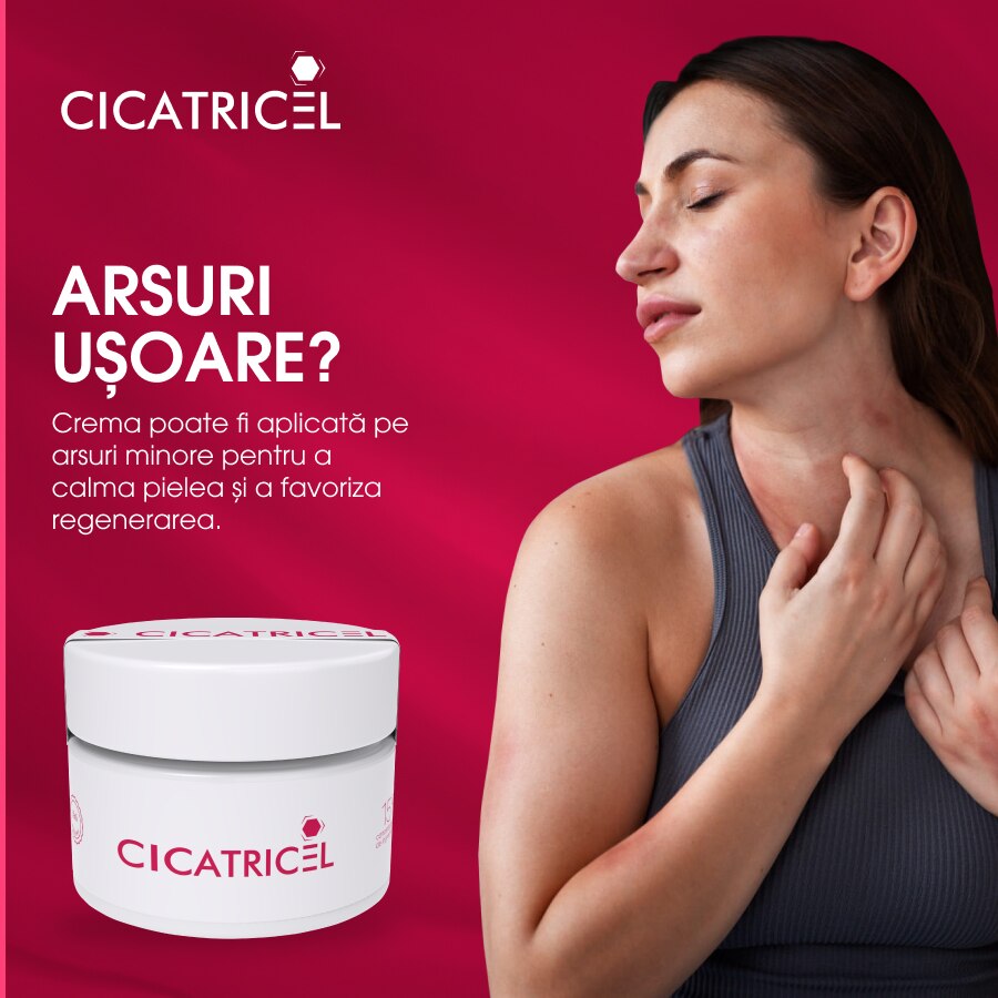 Crema Naturista Cicatricel - Vindecare Rapida pentru Tatuaje, Rani ...