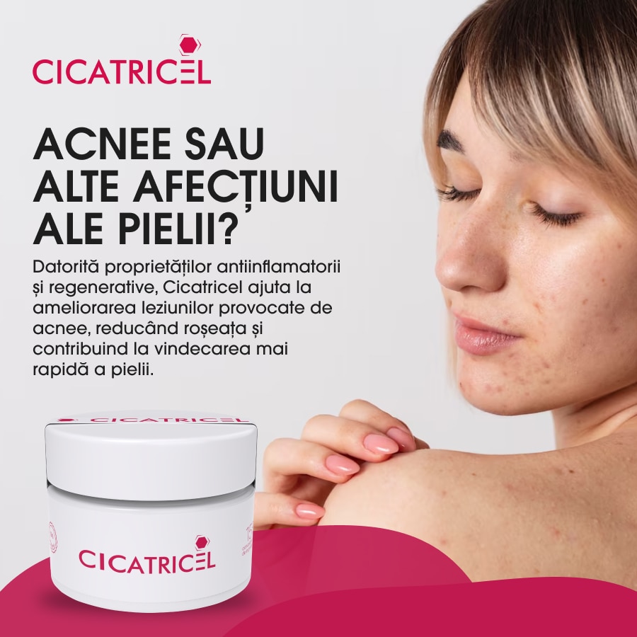 Crema Naturista Cicatricel - Vindecare Rapida pentru Tatuaje, Rani ...