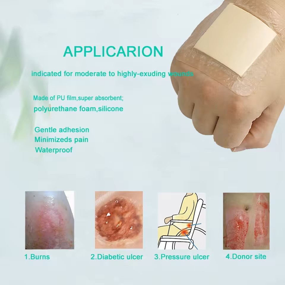 Pansament antiescara, ulcere varicoase, Alhena®, incizii operatorii ...