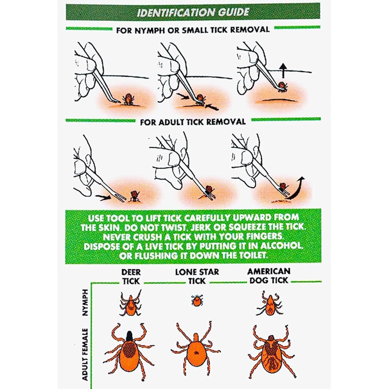 Kit de indepartare capuse Rqiurpn, cu etui din piele ecologica, card ...