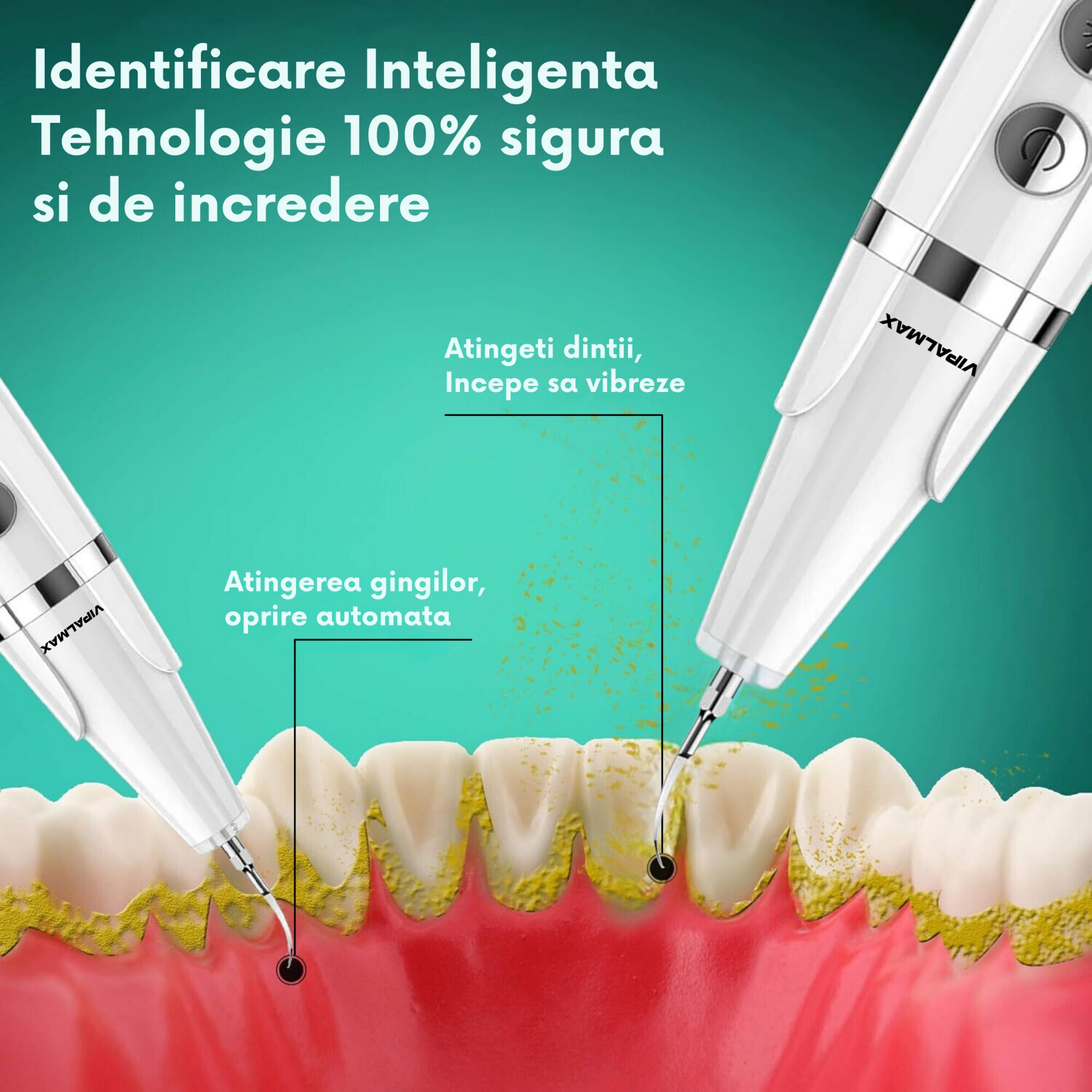 Aparat pentru Detartraj VIPALMAX®, Dispozitiv Eliminare Tartru si ...