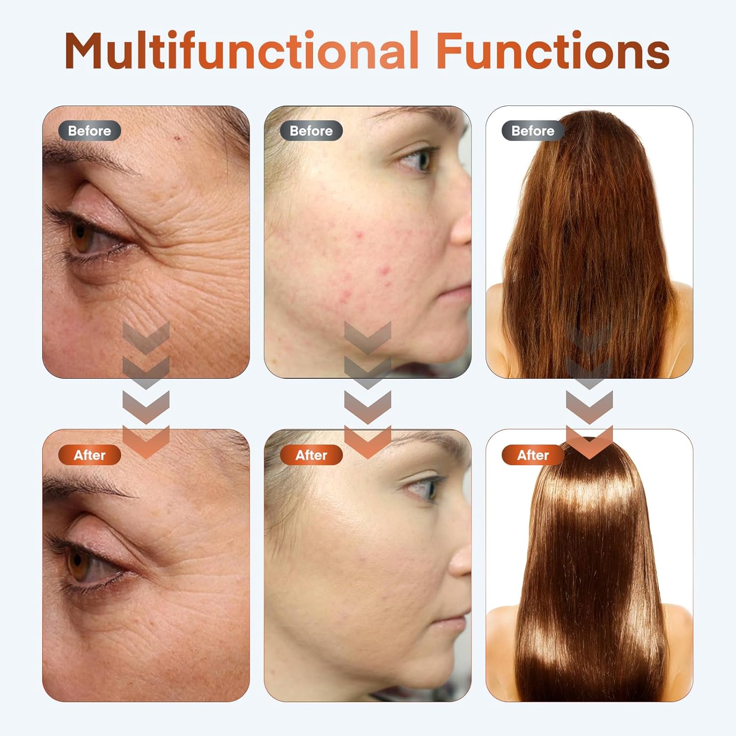 Electroderm Устройство за козметично лечение，SHIJOOE，преносимо，високочестотна аргонова ...