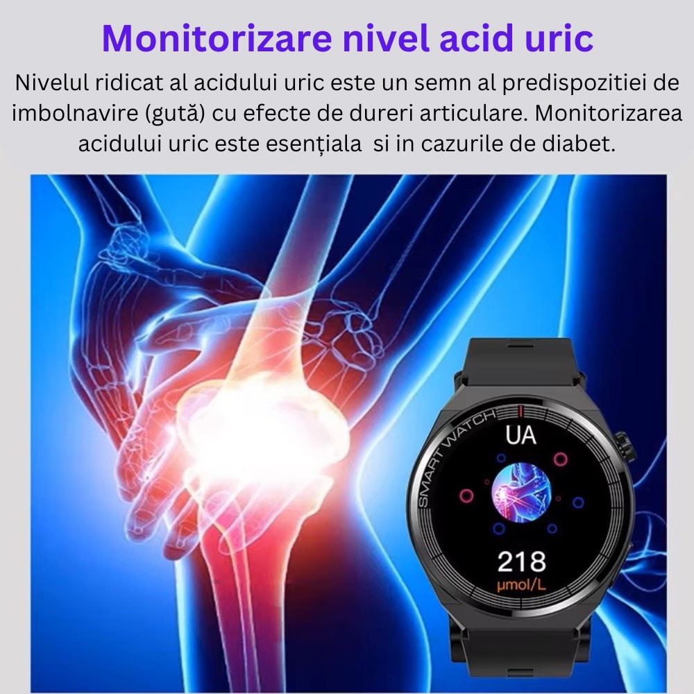 Ceas smartwatch medical, Cumparaturescu, functie de monitorizare la ...
