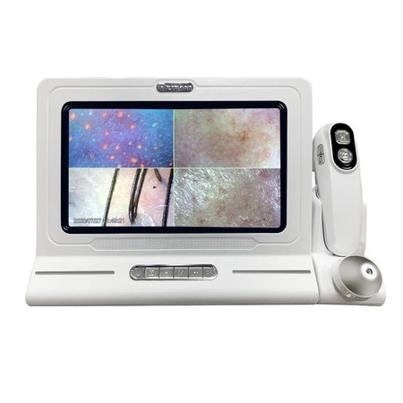 Aparat de analiza scalp, cu camera HD, design integrat, spectru de ...