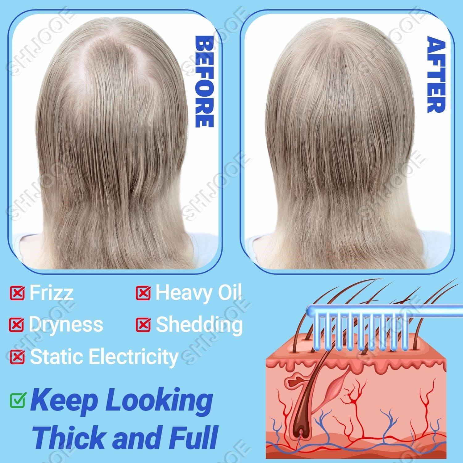 Aparat Electroderm pentru tratament cosmetic，SHIJOOE®，portabil ...