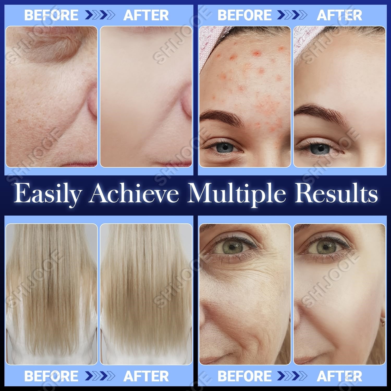 Aparat Electroderm pentru tratament cosmetic，SHIJOOE®，portabil ...