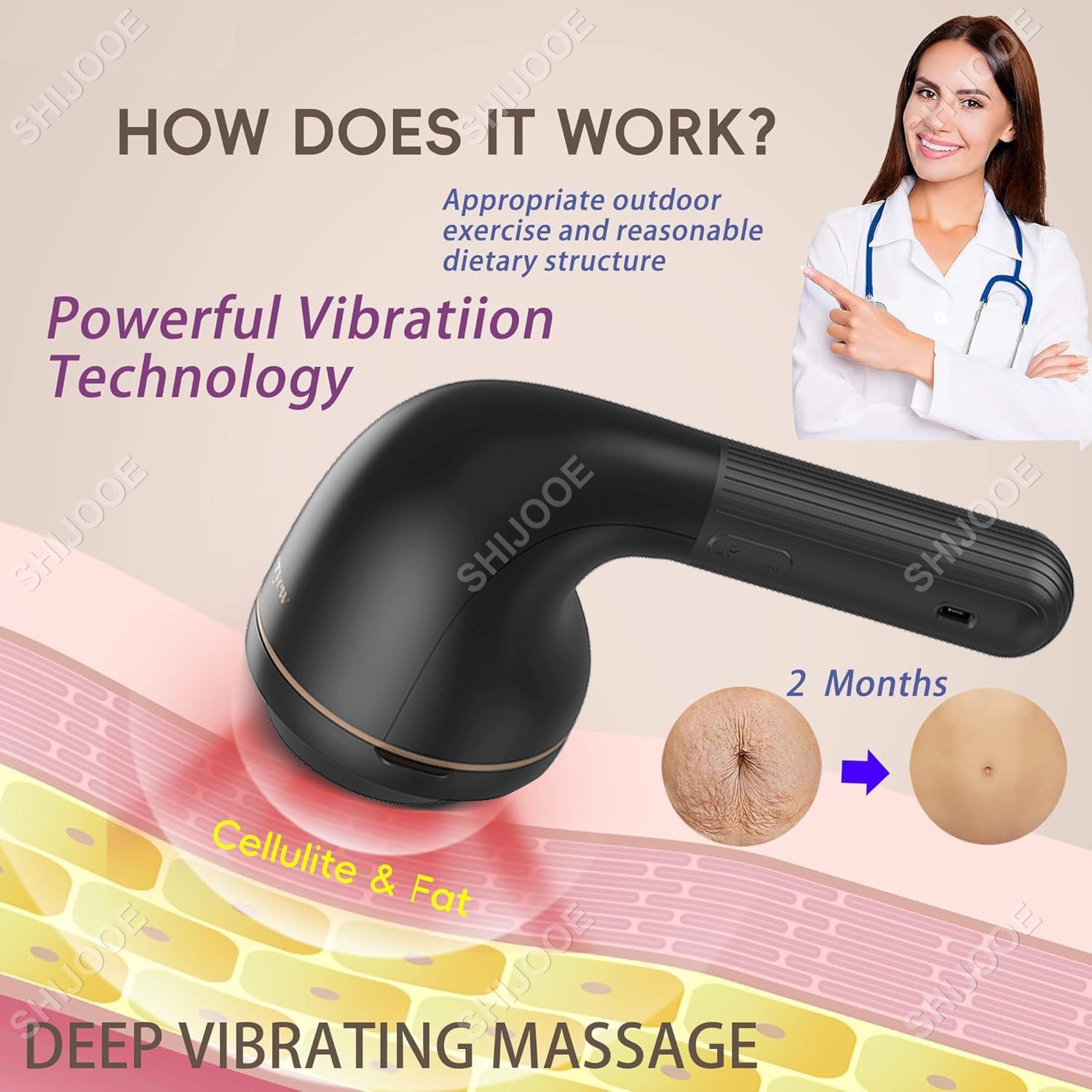 Професионален антицелулитен масажор, SHIJOOE®, безжичен, с 8 масажни глави, с 2 подложки ...