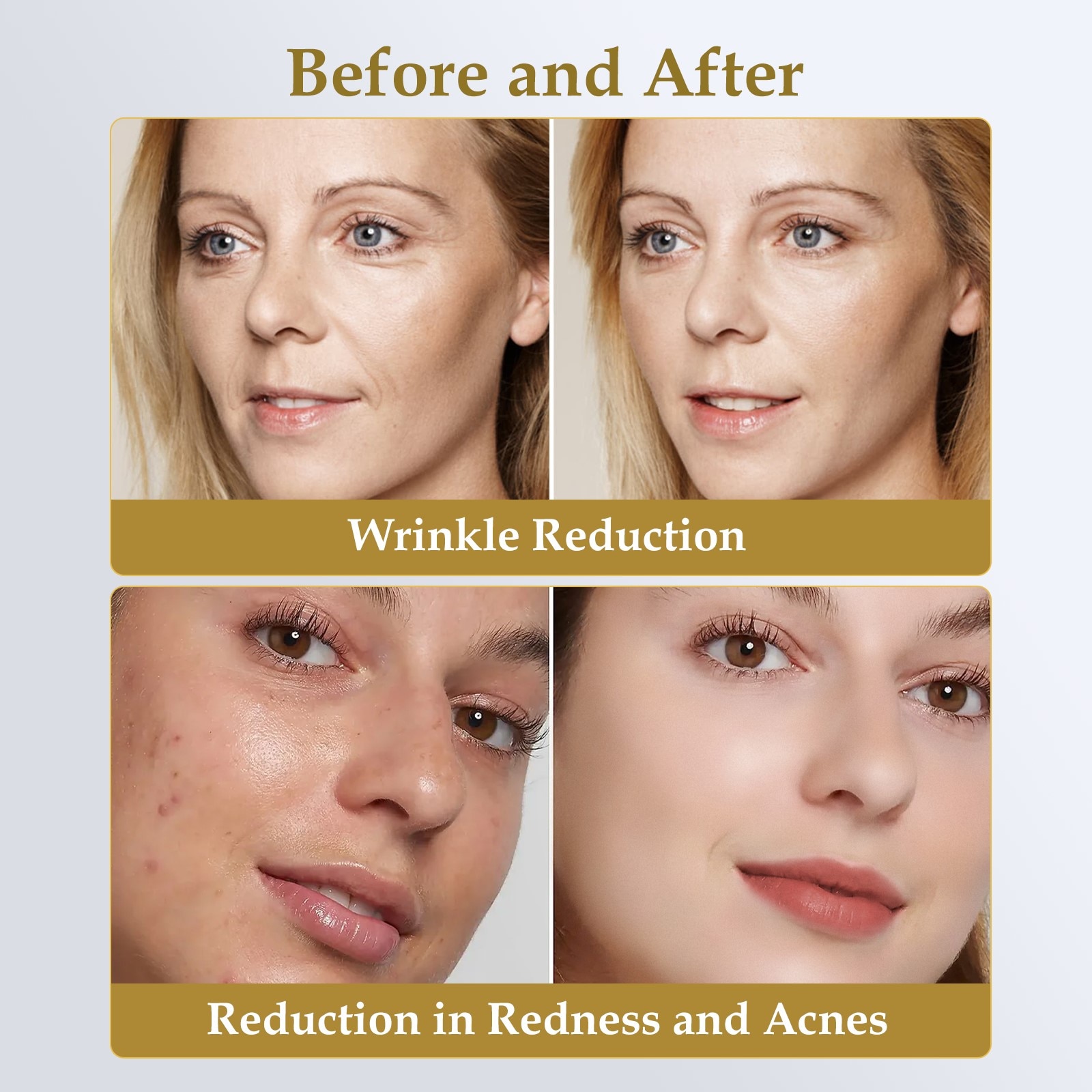 Masca faciala LED Veraylife, 8 moduri, tehnologie infrarosu, silicon ...