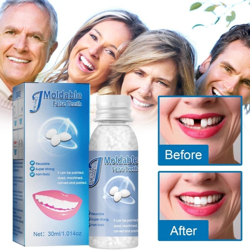 Kit Urgenta Reparatie Dinti 30ml - Plomba Termoplastica Temporara cu ...