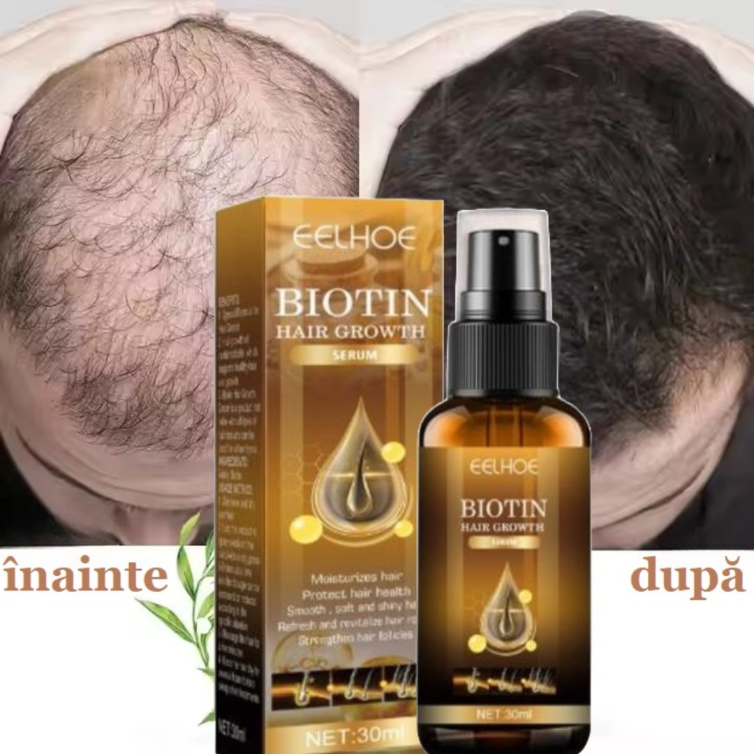 4 x Ser Biotina pentru Par, Tratament Avansat Crestere Rapida, Intarire Fire, Prevenire Cadere ...