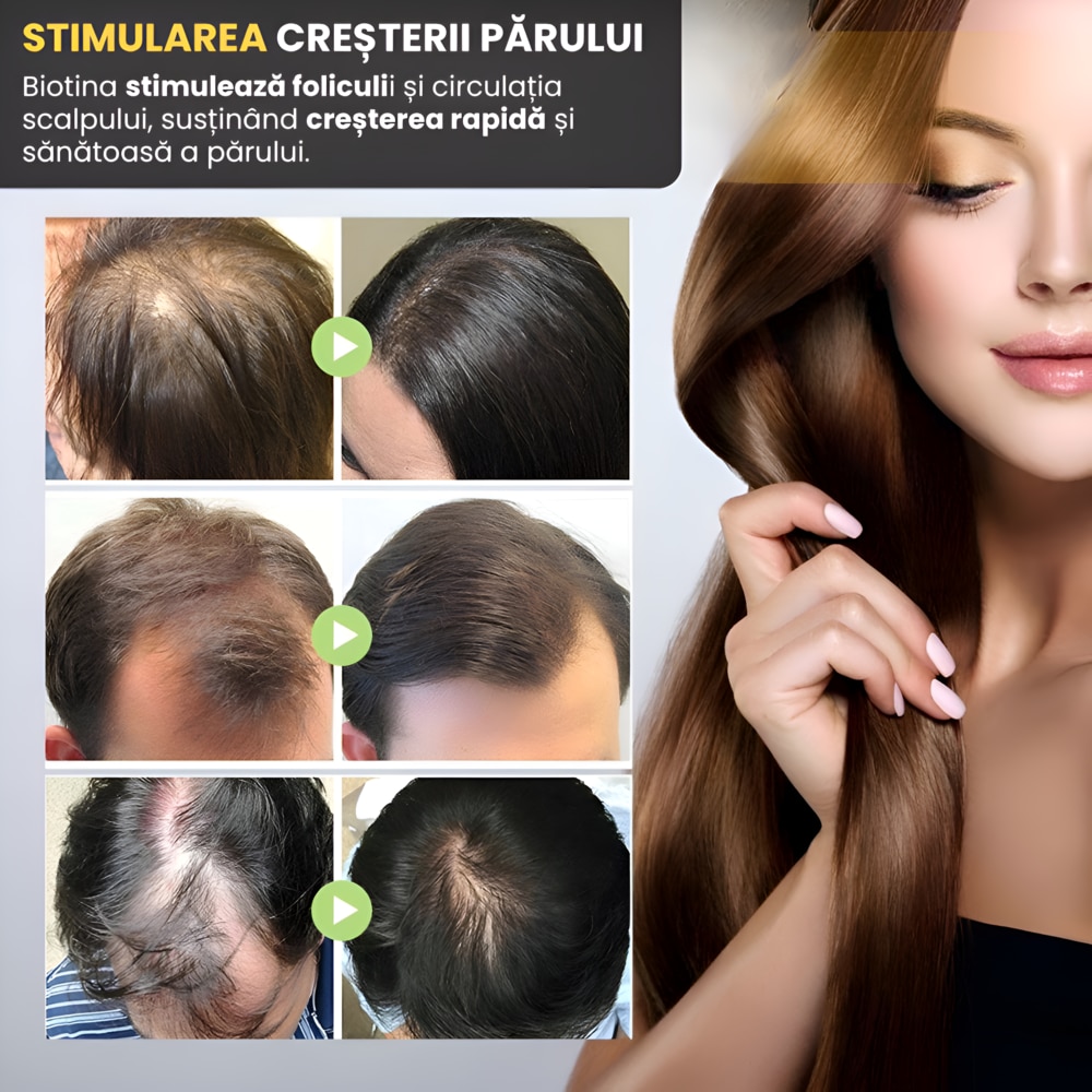 4 x Ser Biotin pentru Par, Tratament Crestere Rapida, Intarire Fir, Opreste Caderea Parului ...