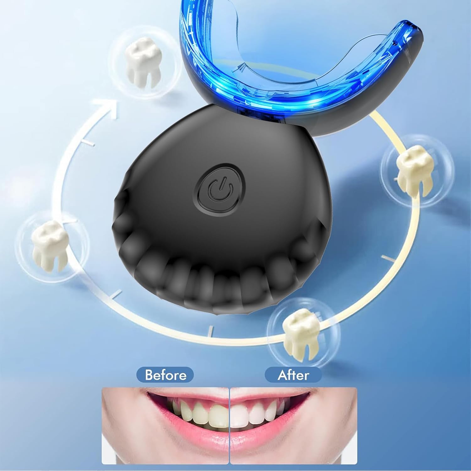 Kit Albire a Dintilor pentru Uz Casnic, BYONDSELF®, cu Lumina LED ...