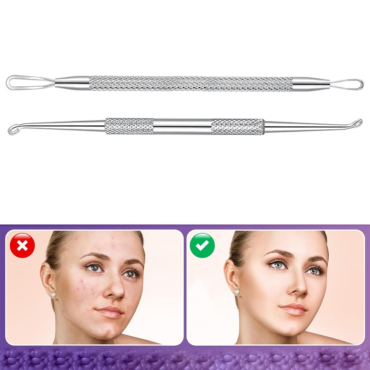 Ustensile pentru eliminarea punctelor negre Zenifique, 2 piese, din ...