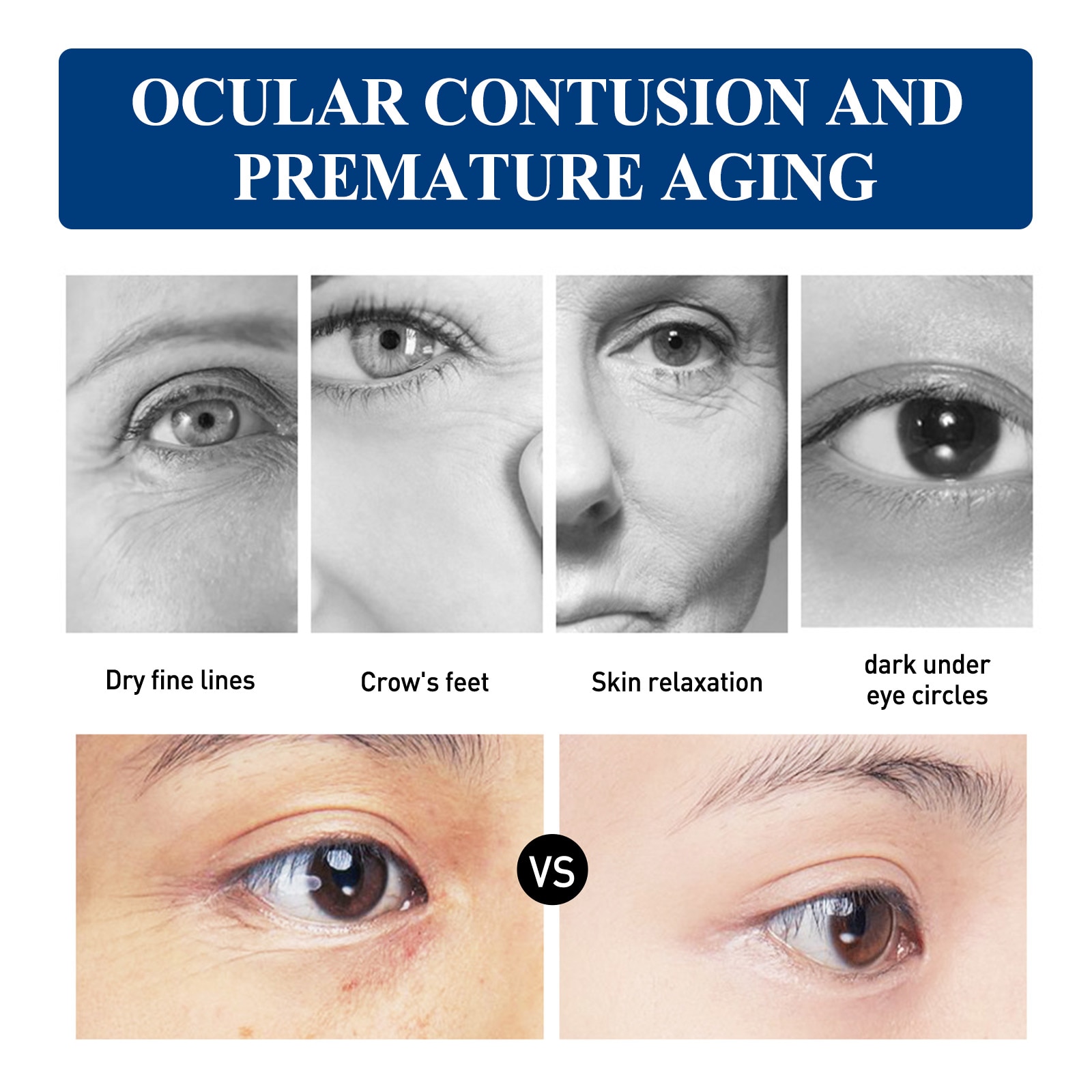 Crema pentru ochi cu colagen, EELHOE, reduce cearcane, netezeste ...