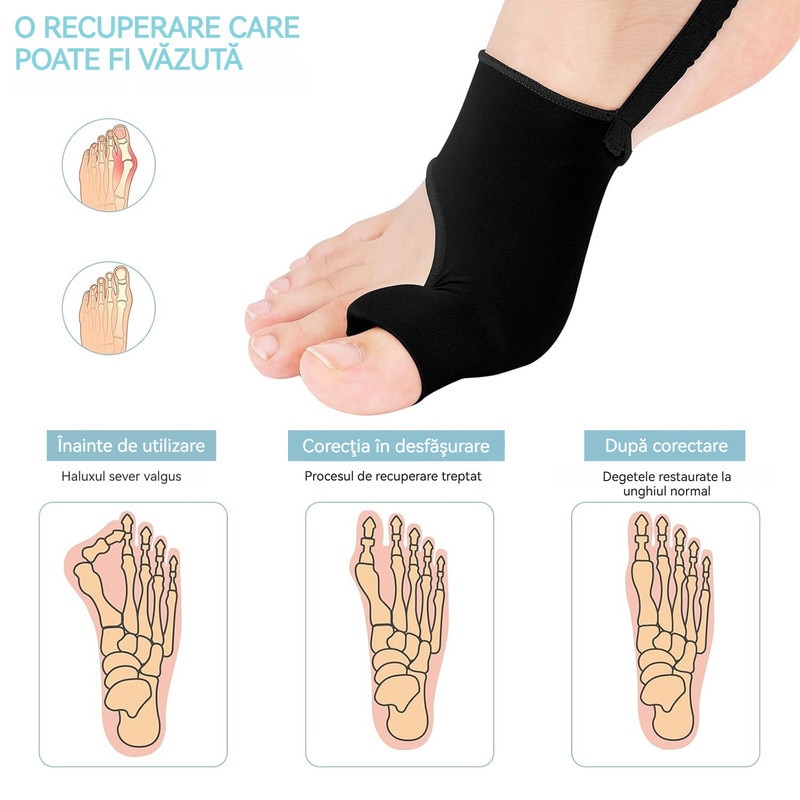 Set 4 protectii pentru monturi si separator degete, YSBER, Nylon ...